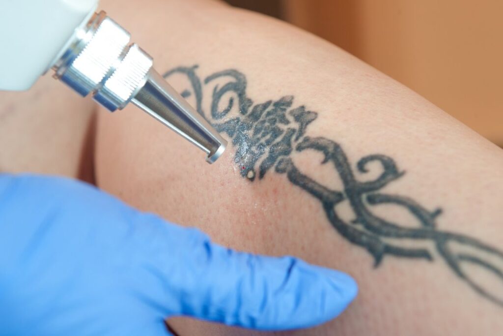 Waxing Contraindications: When Clients Shouldn’t Get Waxed - Welp Magazine